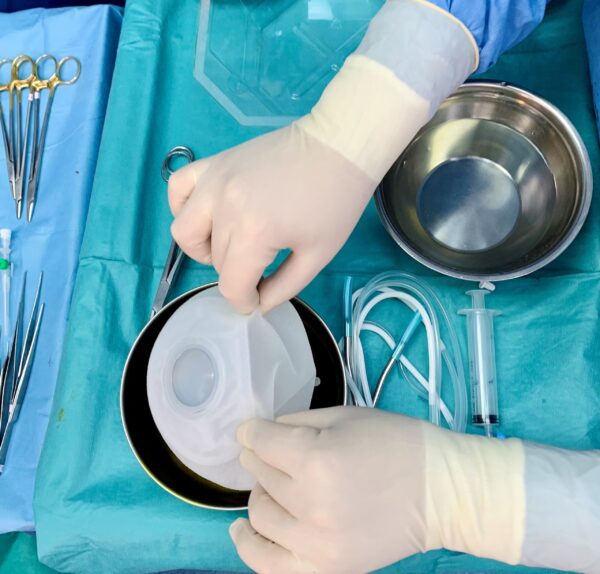 Αποκατάσταση Μαστού Μετά Από Μαστεκτομή - Βασίλειος Καλλές MD, MSc, PhD ...